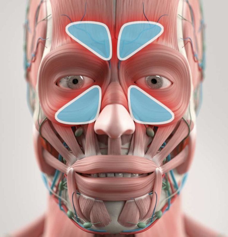 Sinus Surgery - Los Angeles ENT Doctor
